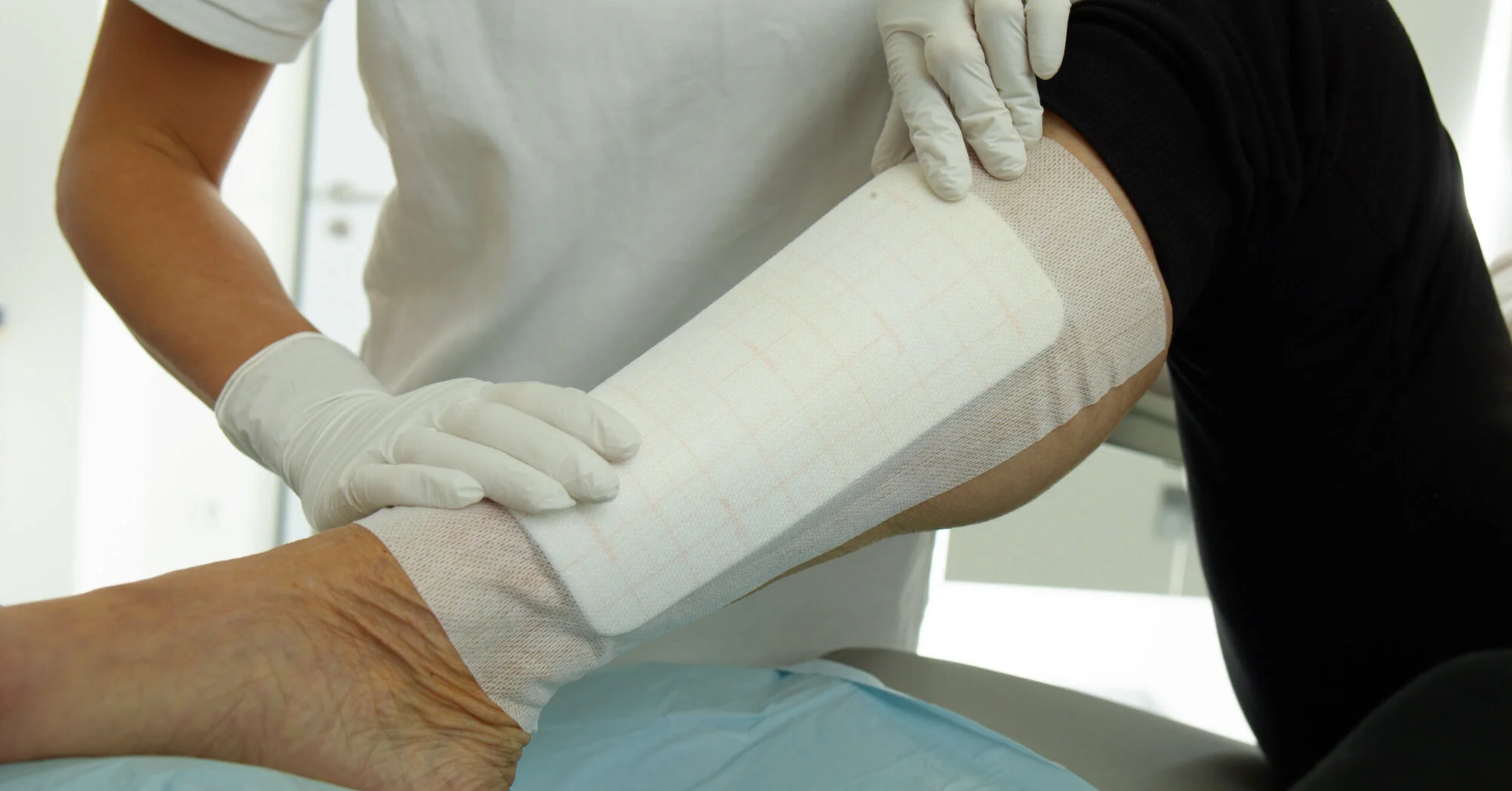 Moderne Wundversorgung: Materialien, Wundauflagen