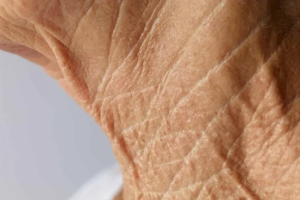 Pergamenthaut, Altershaut: Pflege und Wundbehandlung