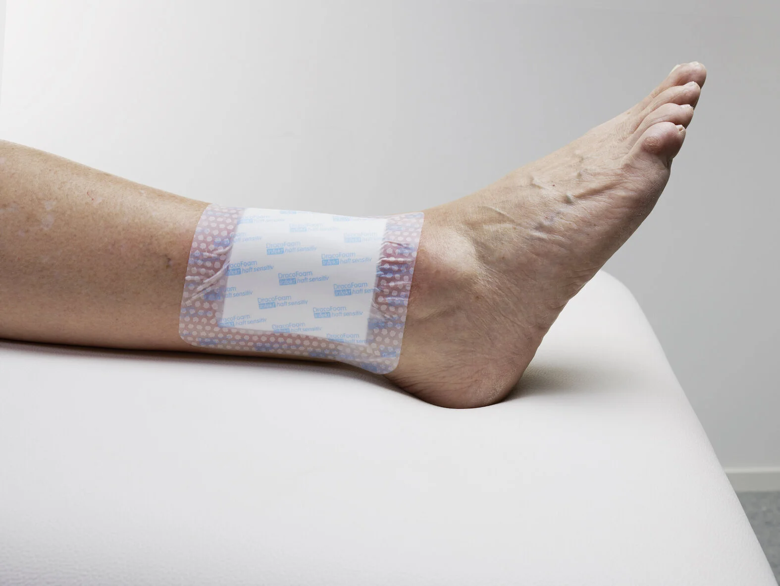 Infizierte Wunden: Wundinfektion und septische Wunden behandeln