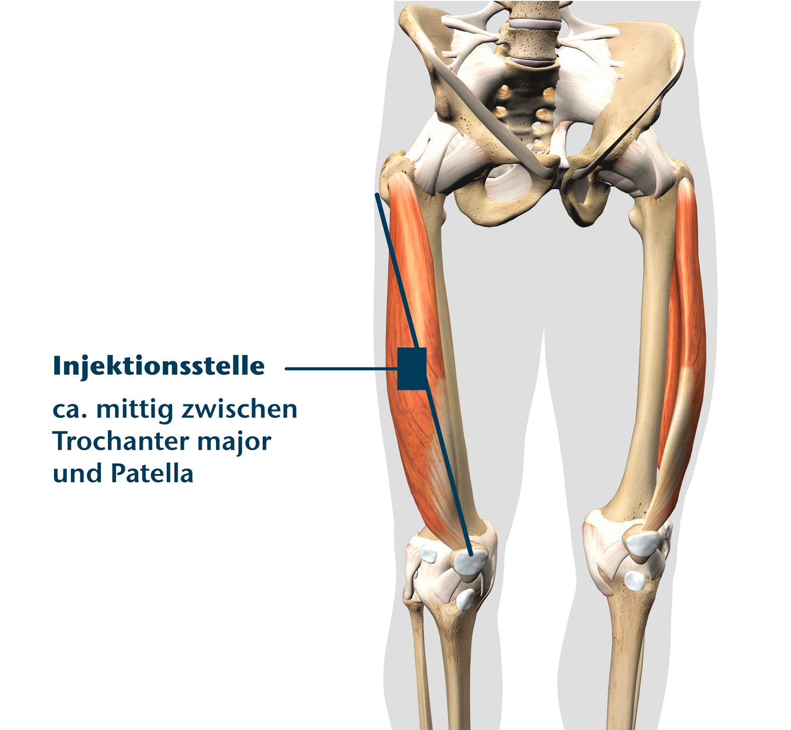 Injektionen verabreichen: Injektionsarten und Vorbereitung