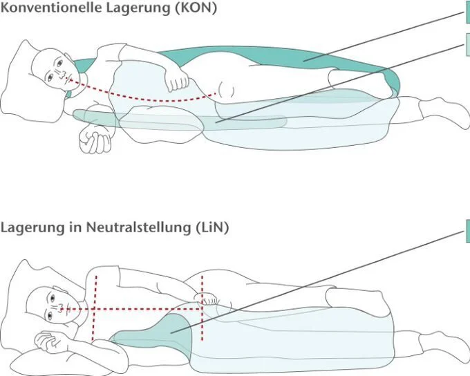 LiN-Lagerung - Lagerung in Neutralstellung
