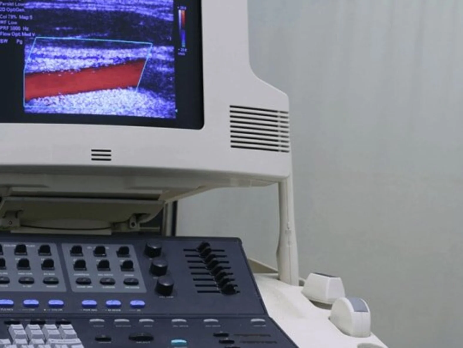 Ulcus cruris arteriosum - Diagnose und Wundversorgung