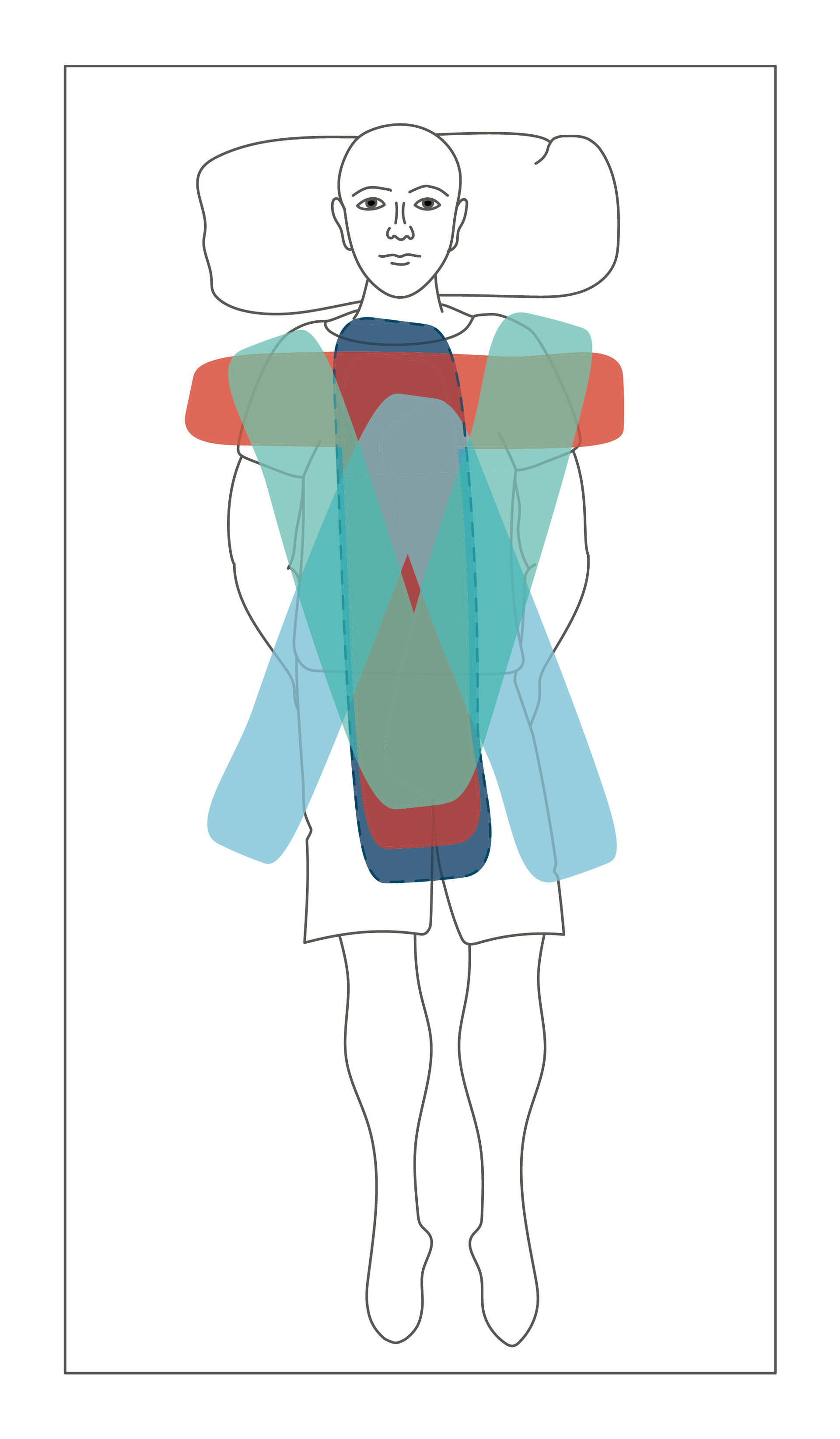 VATI-Lagerung: Pneumonie-Prophylaxe und Belüftung der Lunge - DRACO