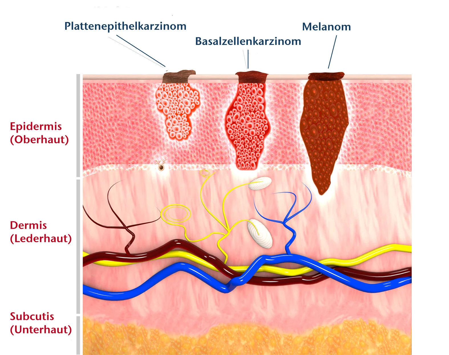 Wunden und Hauterkrankungen bei stark pigmentierter Haut