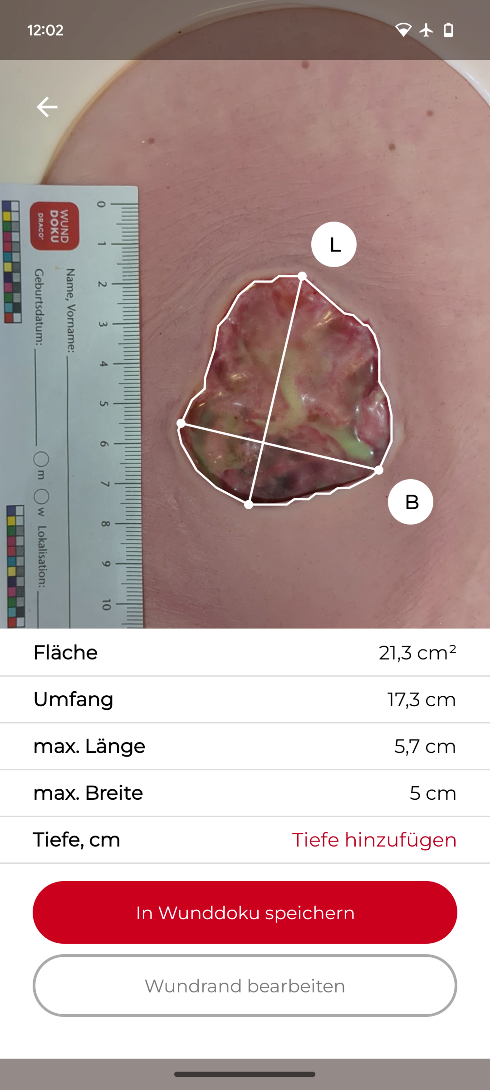 Automatische Wundvermessung: Draco Wunddoku-App