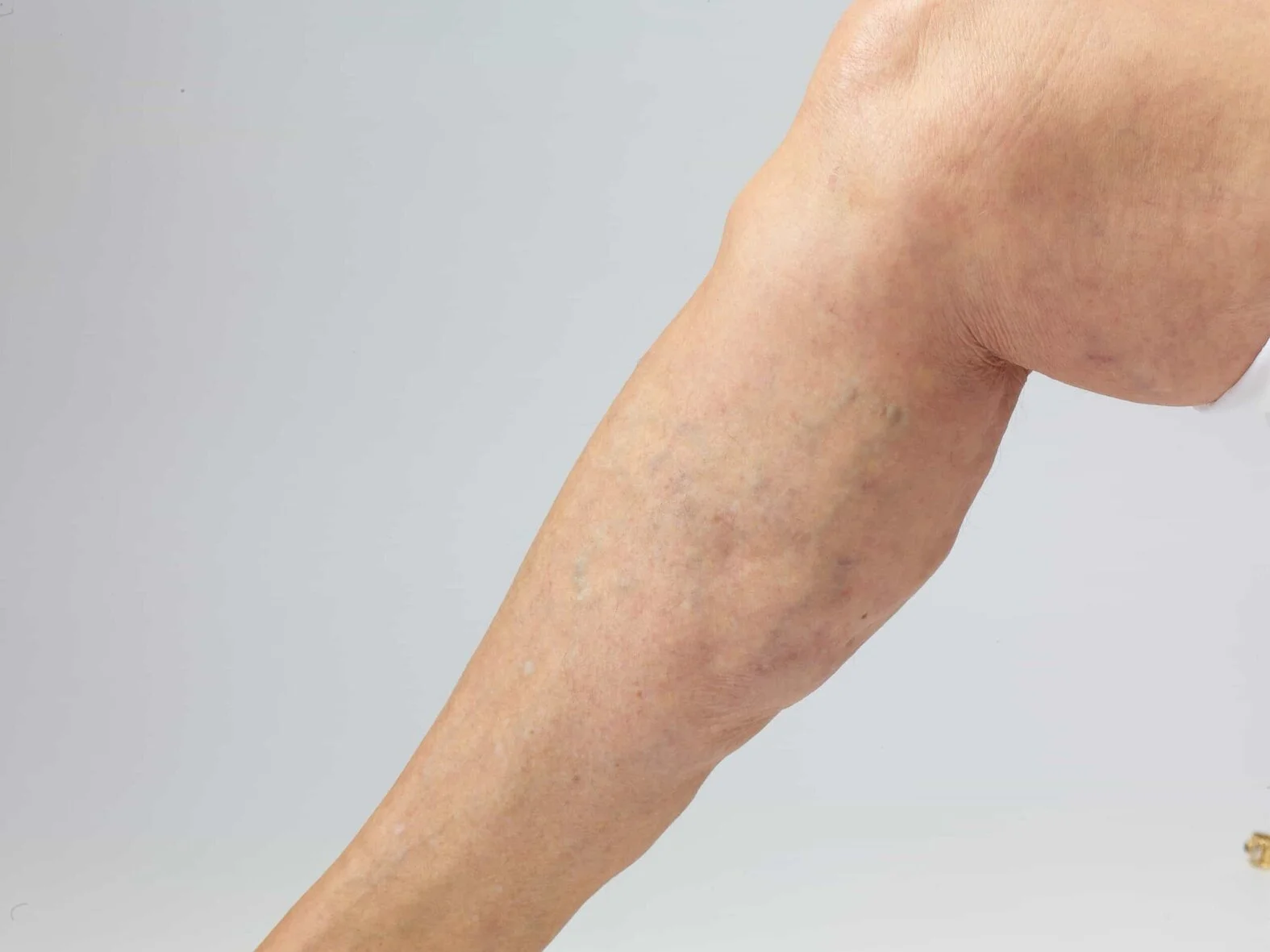 Pergamenthaut, Altershaut: Pflege und Wundbehandlung